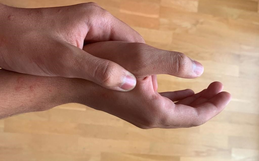 Tendinitis de Quervain o Tenosinovitis - Clínica Fuensalud