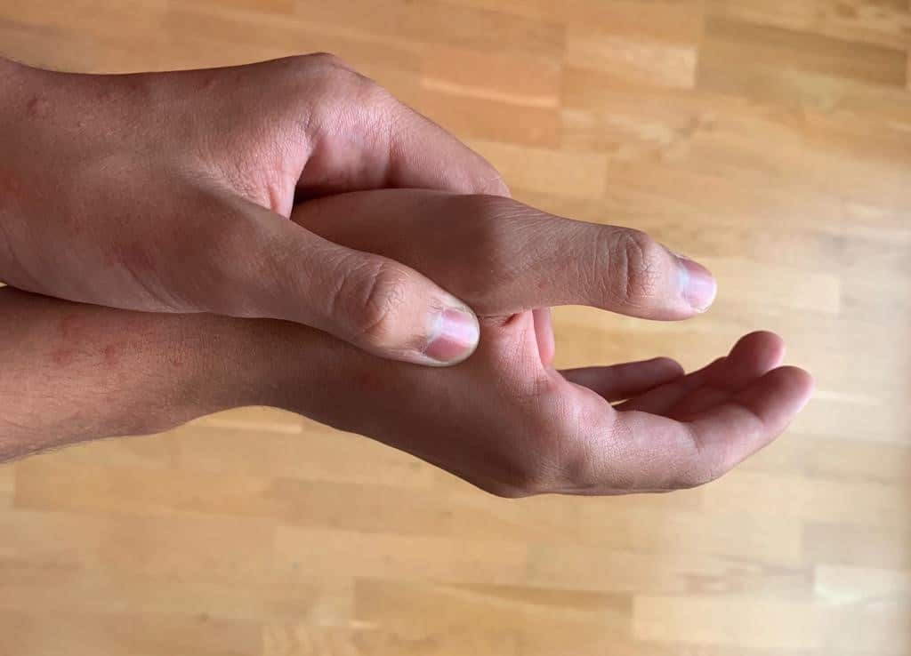 Tendinitis de Quervain o Tenosinovitis - Clínica Fuensalud