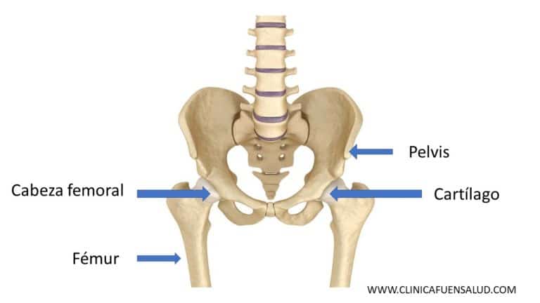 Artrosis de cadera y siete consejos a seguir - Clínica Fuensalud