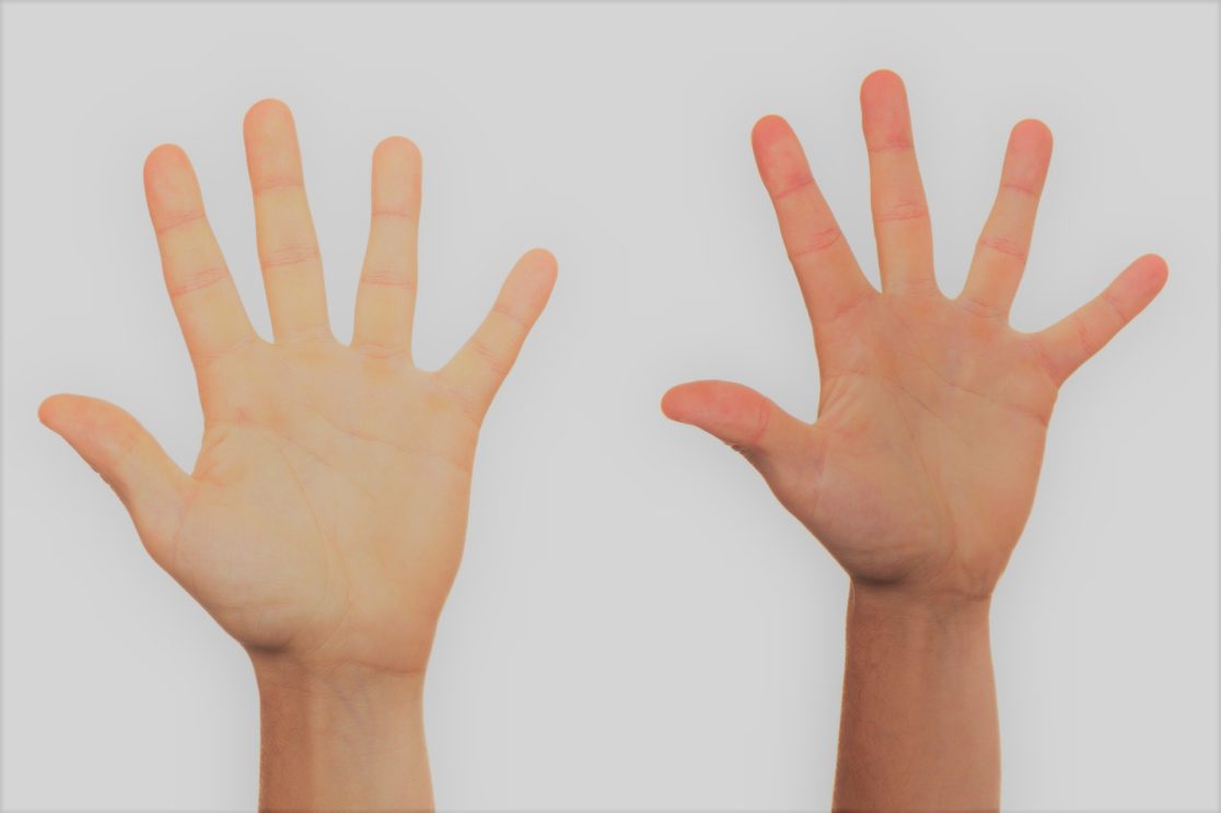 Enfermedad de Dupuytren y su tratamiento - Clínica Fuensalud
