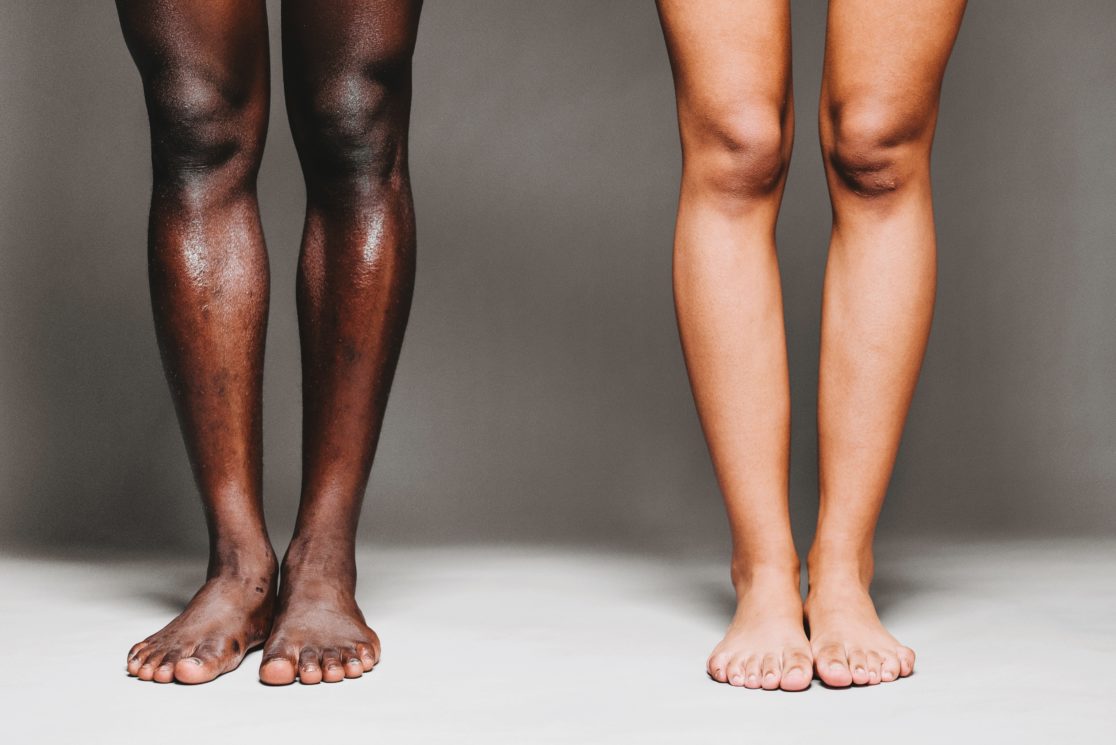 Artrosis de rodilla tratada con fisioterapia - Clínica Fuensalud