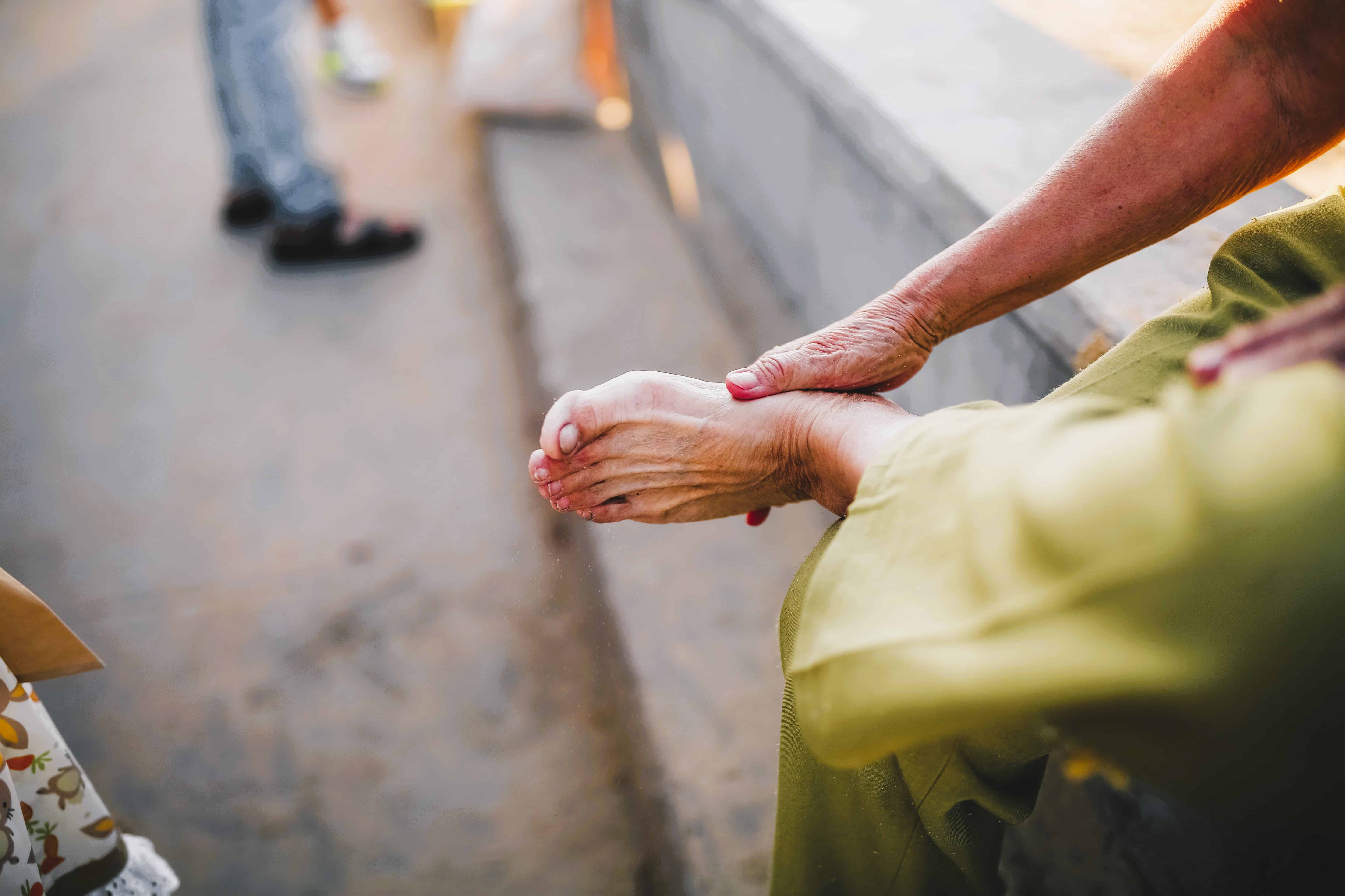 Pie reumático y tratamiento podológico. - Clínica Fuensalud