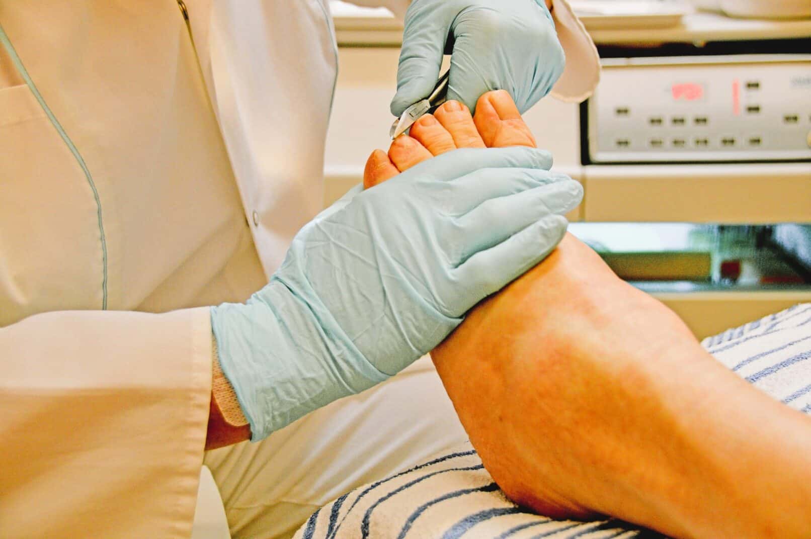 Pie reumático y tratamiento podológico. - Clínica Fuensalud